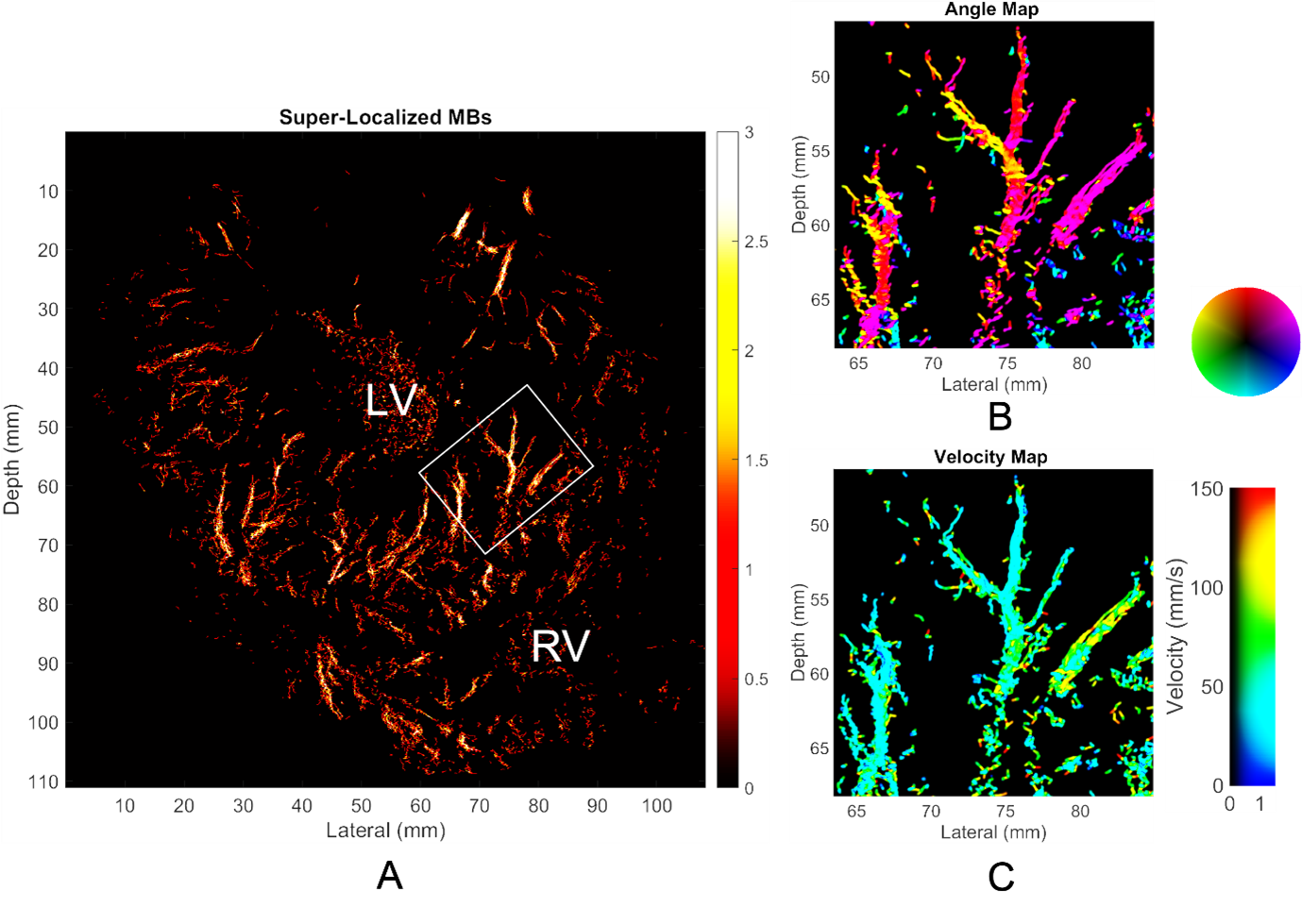 Myocardial Microvasculature