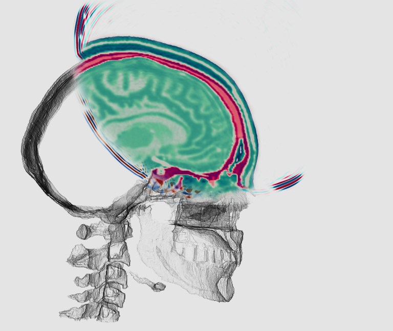 Full-waveform inversion imaging of the human brain